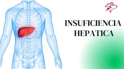 Insuficiencia Hepática Angela Perez Udocz