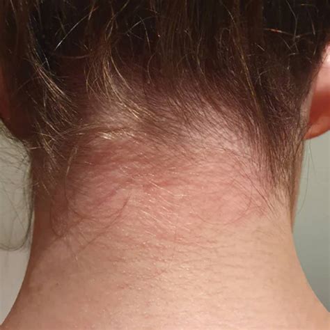 BeKynd Beauty Revive Restore Exfoliating Scalp Scrub