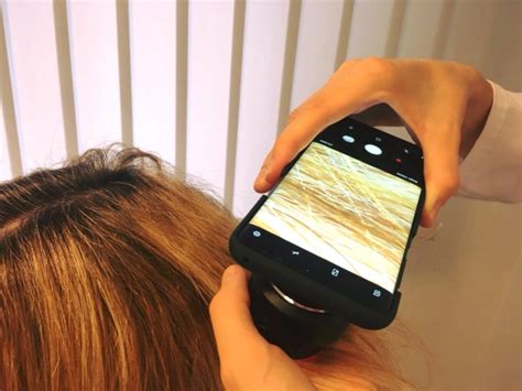 Trichoscopy Veselības Centrs 4