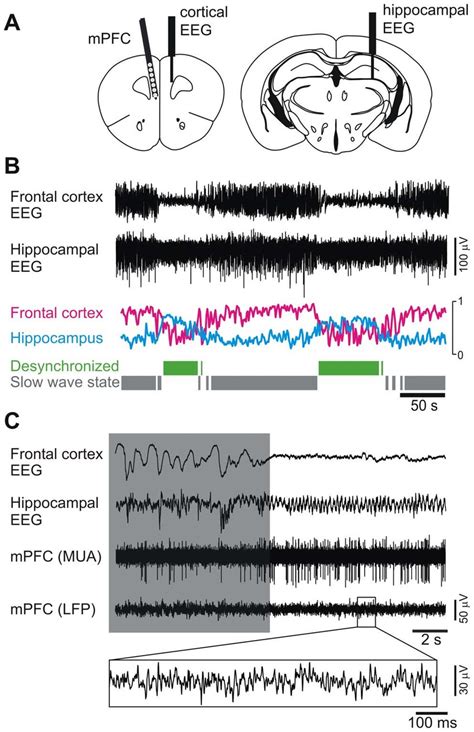 Recording Of MPFC Activity Under Different Global Brain States A Download Scientific Diagram