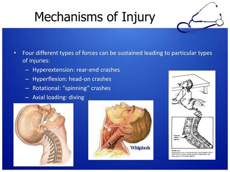 Ppt Spinalneck Trauma Powerpoint Presentation Free Download Id