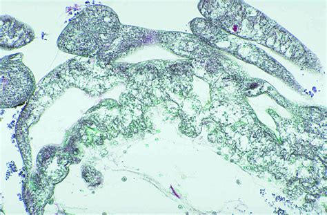 Physarum Polycephalum Plasmodium Slide Prepared Slides