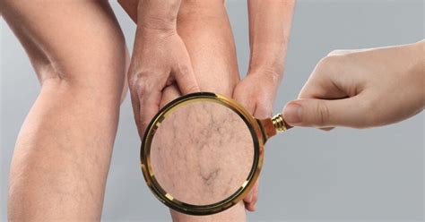 Enlarged Preauricular Lymph Nodes Causes And Treatment Purehealth