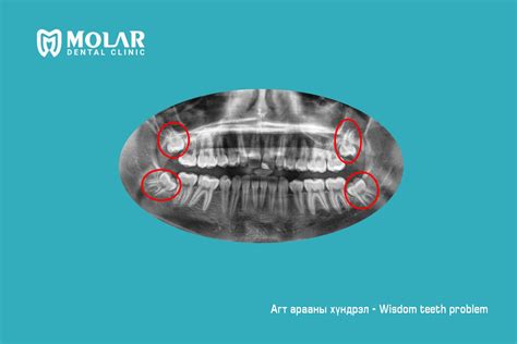 АГТ АРААНЫ ХҮНДРЭЛ Молар Дентал Клиник