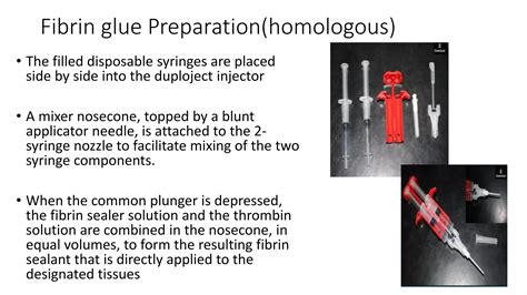 Fibrin Glue In Ophthalmology Pptx