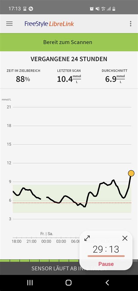 Omnipod Infection R Type1diabetes