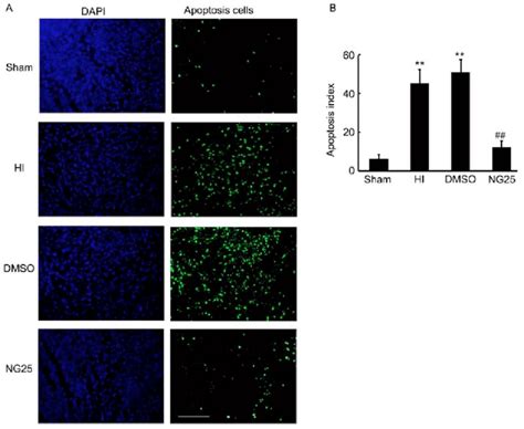Apoptosis Detection By Tunel Assay In The Brain Cortex A Download Scientific Diagram