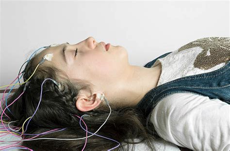 Eletroencefalograma Eeg Córtex Neurologia Diagnóstica