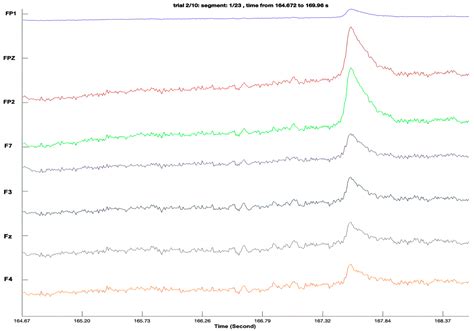 Introducing A New Mobile Electroencephalography System And Evaluating Its Quality In Comparison