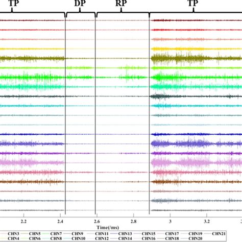 Signal Segmentation For Labeling Download Scientific Diagram