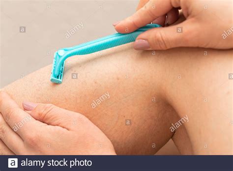 Folliculitis Hi Res Stock Photography And Images Alamy