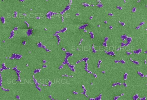 Acinetobacter Baumannii Bacteria Sem Stock Image Science Source Images
