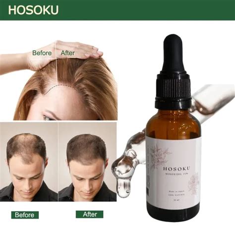 Minoxidil Hosoku Hair Grower Premium