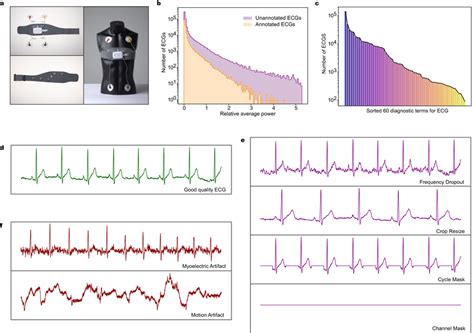 Information For The Large Scale Ecg Dataset A Wearable Ecg Device And Download Scientific