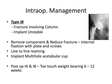 Intraoperative Acetabular Fracture And Pelvic Discontinuity In Thr Pptx Intraoperative Acetabular Fracture And Pelvic Discontinuity In Thr Pptx
