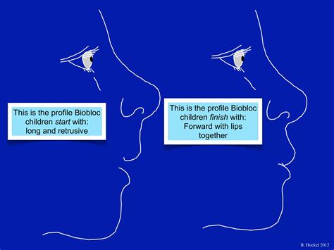 De Extraction Explanation Pdf
