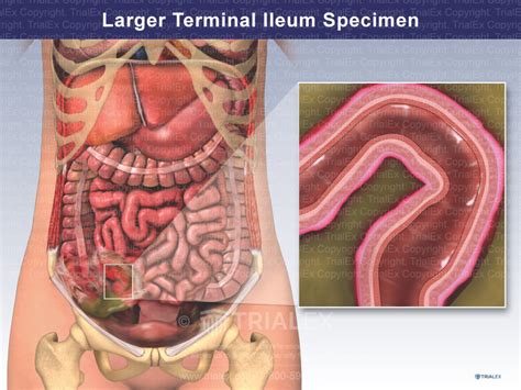 Terminal Ileum Anatomy Stock Bowel Normal Anatomy — Illustrated