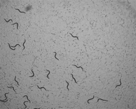 Worm Detection Object Detection Dataset And Pre Trained Model By Worm