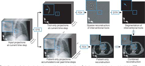 Figure 1 From Deep Learning Based Reconstruction Of Interventional