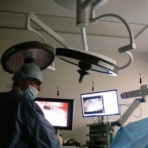 A Case Of Left Hemihepatectomy In A Patient With Left Hepatic Download Scientific Diagram