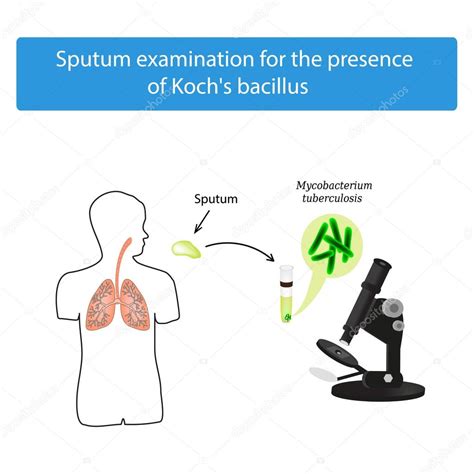 Sputum Examination World Tuberculosis Day Infographics Vector Illustration On Isolated