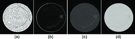 Hessian Features A The Vesselness Features Image B The Download Scientific Diagram