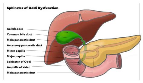 Sphincter Of Oddi Dysfunction Treatment And Management Point Of Care