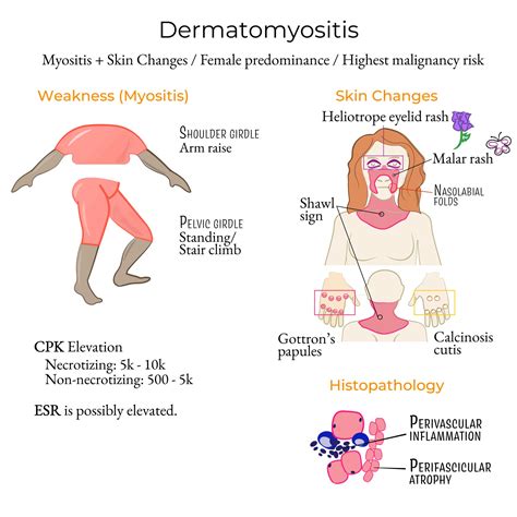 Neuroanatomy Glossary Dermatomyositis Ditki Medical And Biological Sciences