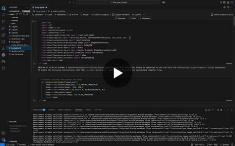 Lung Disease Detection Using Resnet50 And Image Classification This Project Focuses On Building