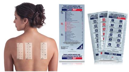 Types Of Patients To Treat In Your Patch Testing Clinic SmartPractice Blog