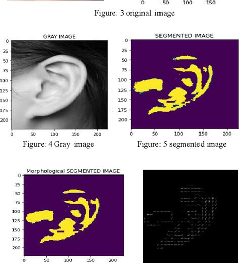Figure 4 From An Efficient Ear Biometric Authentication System Semantic Scholar