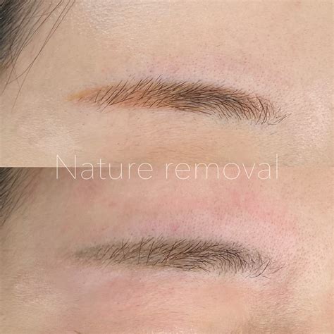 네이쳐👩🏻‍🔬ㅣ용산잔흔제거 눈썹문신제거 반영구제거 Naturecustoms • Instagram Photos And Videos