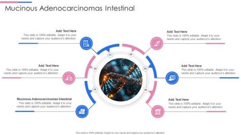 Mucinous Adenocarcinomas Intestinal In Ppt Powerpoint Presentation Slide Templates Cpp Ppt Sample
