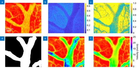 Ls Lsaisi Lsci Image Fusion A A Ls Lsai Flow Image B The