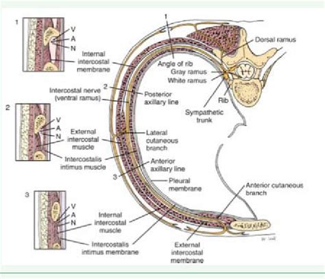 Figure 1 From Intercostal Neuralgia A Review Semantic Scholar