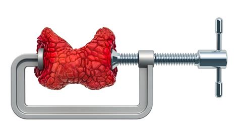 갑 상선 질병 개념입니다 바이스와 인간의 갑 상선 3d 렌더링에 고립 된 흰색 배경 3차원 형태에 대한 스톡 사진 및 기타 이미지 3차원 형태 갑상샘 갑상샘기능