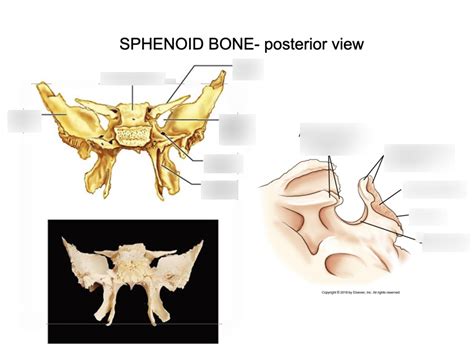 Sphenoid Bone Posterior View Diagram Quizlet