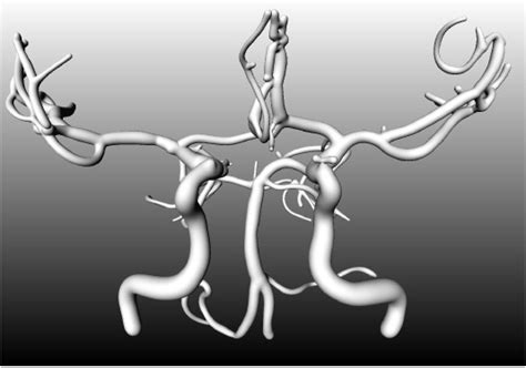 10 Visualization Of Cerebral Vasculature Imaged By Mri Using A Download Scientific Diagram