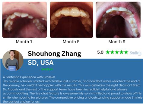 Impression Putty Smileie