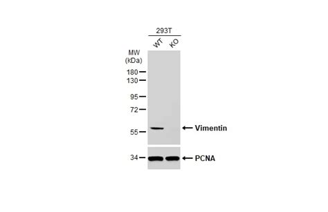 Anti Vimentin Antibody Rabbit Polyclonal Ab137321 Abcam