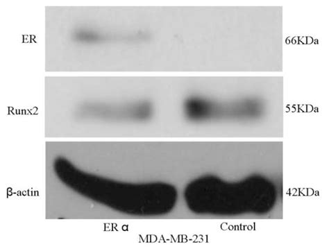 Positive Association Between Nuclear Runx2 And Oestrogen Progesterone