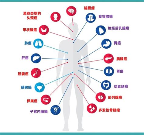 美国癌症研究协会权威发布：2022年，8大危险因素，导致了40％的癌症 腾讯新闻