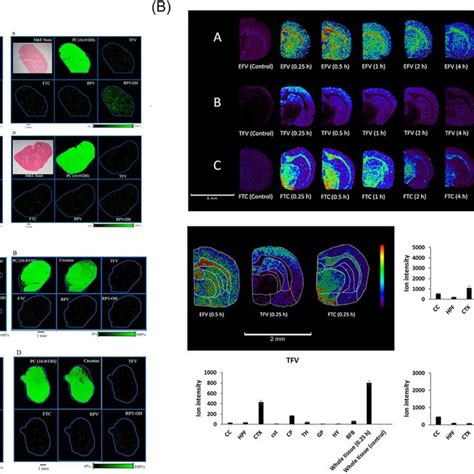 maldi‐msi analysis of four antiretroviral drugs in mouse tissues a
