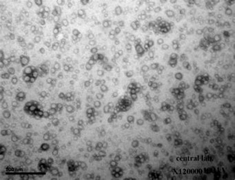 Figure 1 From Development And Optimization Of Ciprofloxacin Hcl Loaded Chitosan Nanoparticles