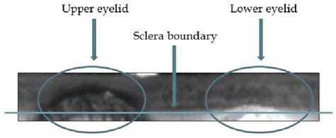 Figure B 2 Extended Normalised Image Used As Input For The Eyelids Download Scientific Diagram
