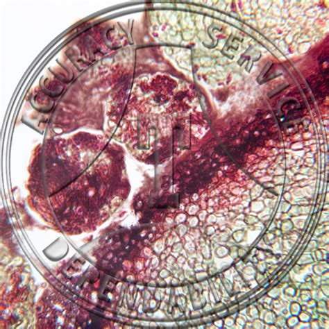 12 M Microscope Slide Claviceps Purpurea Mature Sclerotium Cs