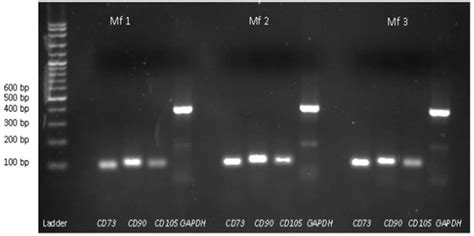 Electrophoregram Of Msc Marker Gene Expression Markers And House Download Scientific Diagram