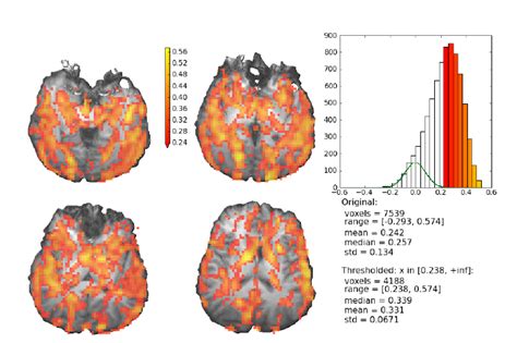 Figure S14 Original And Predicted Fmri Time Series For Representative Download Scientific