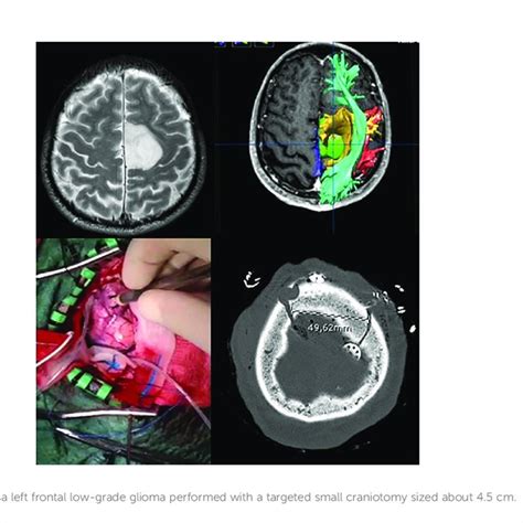 Calculating The Signal To Noise Ratio Snr For Calculating The Snr