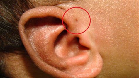 Топ 10 аномалии в човешкото тяло Youtube